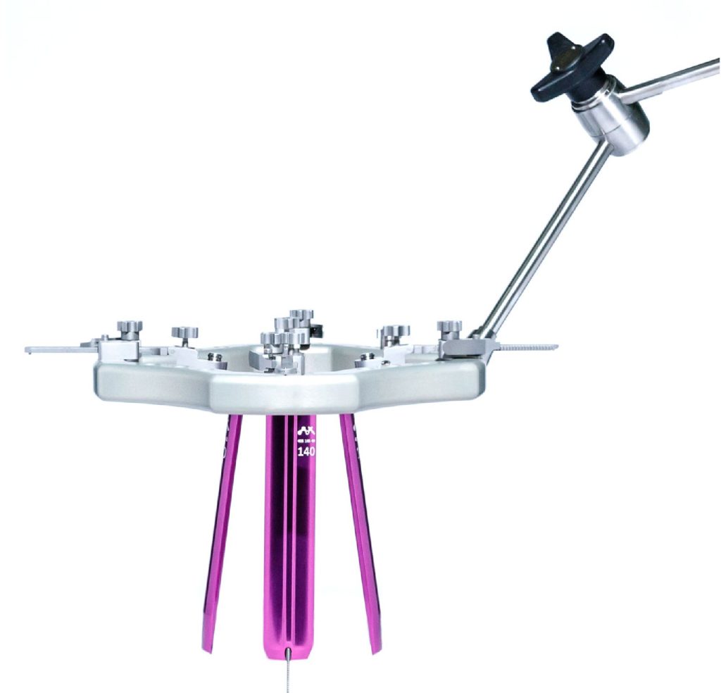 Nacional - NeuroSpine | Implantes Quirúrgicos